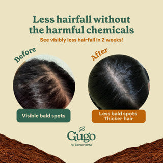Gugo Strengthening Hair Serum – Zenutrients